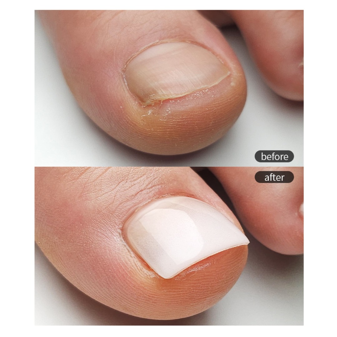 DIAMI EASY PEDI TIPS ペディチップ | DIAMI | ネイル用品・ネイル商材専門の通販｜TAYOU【タユウ】